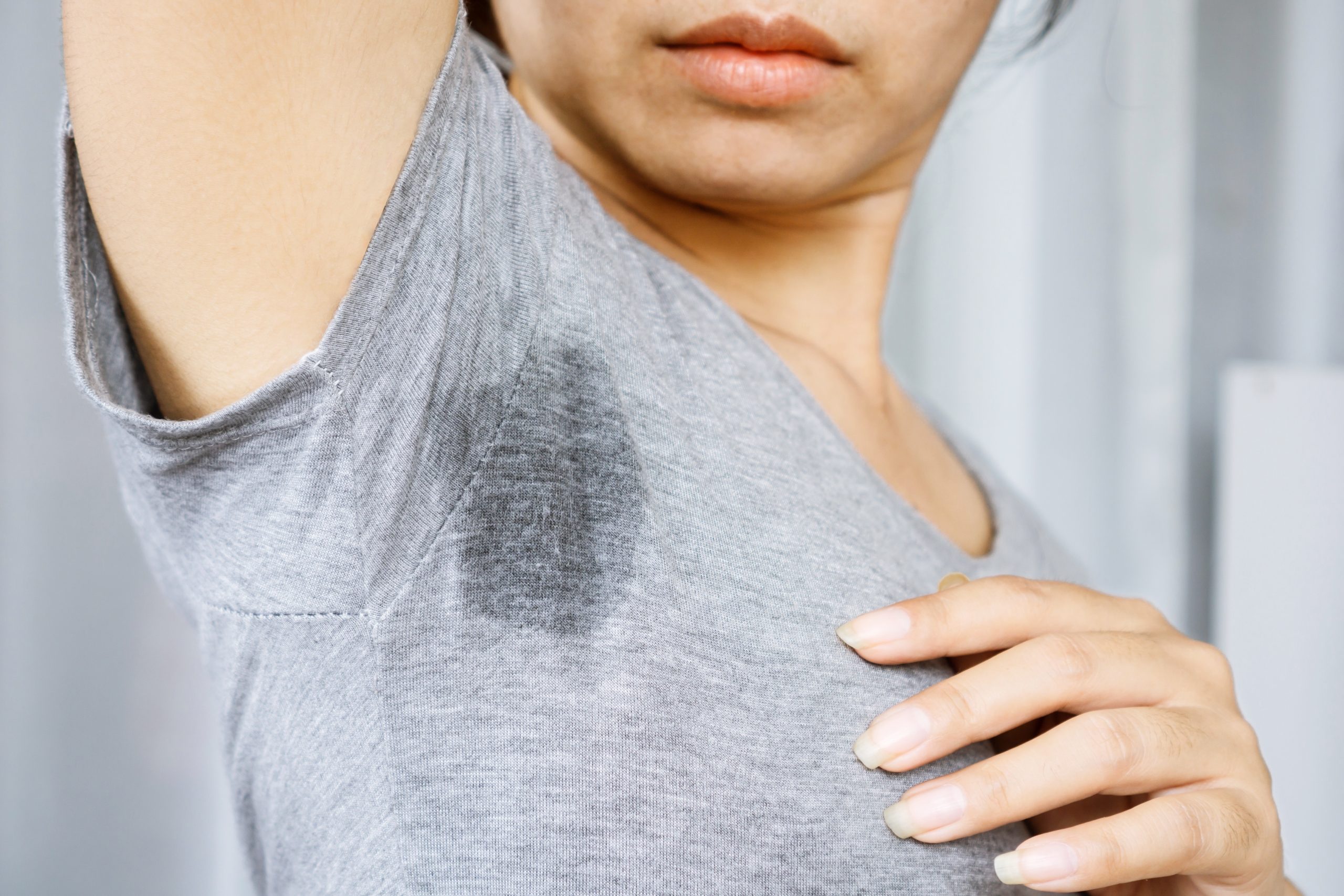 Excessive underarm Sweating - A Aesthetics
